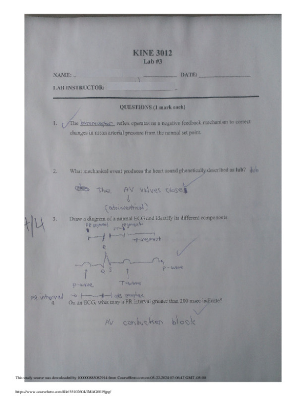 KINE 3012 Lab #3 | The _ reflex operates as a negative feedback ...