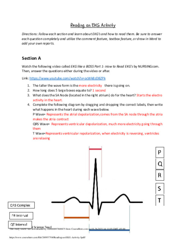 Reading an EKG Activity 3